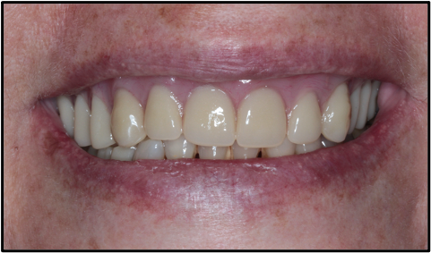 Prosthodontics Kitchener ON, TriCity Dental Specialists
